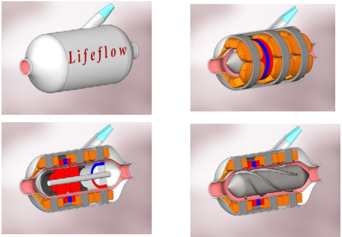 Ventricular Assist Device - MAGNETIC BEARINGS